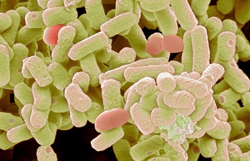 Escherichia coli, Staphylococcus aureus y Klebsiella pneumoniae ...